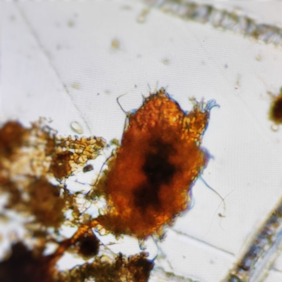 Tardigrades – The Ultimate Survivors?